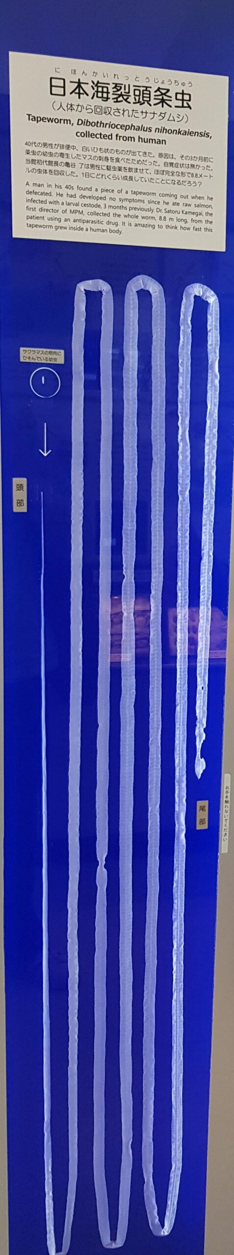 8.8 metre tapeworm from the Meguro parasite museum. - Alo Japan All ...